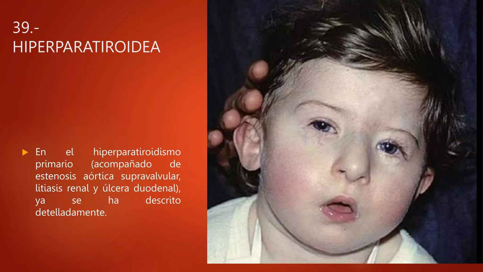TIPOS DE FACIES | PPTX | Eye and Vision Conditions | Diseases and ...