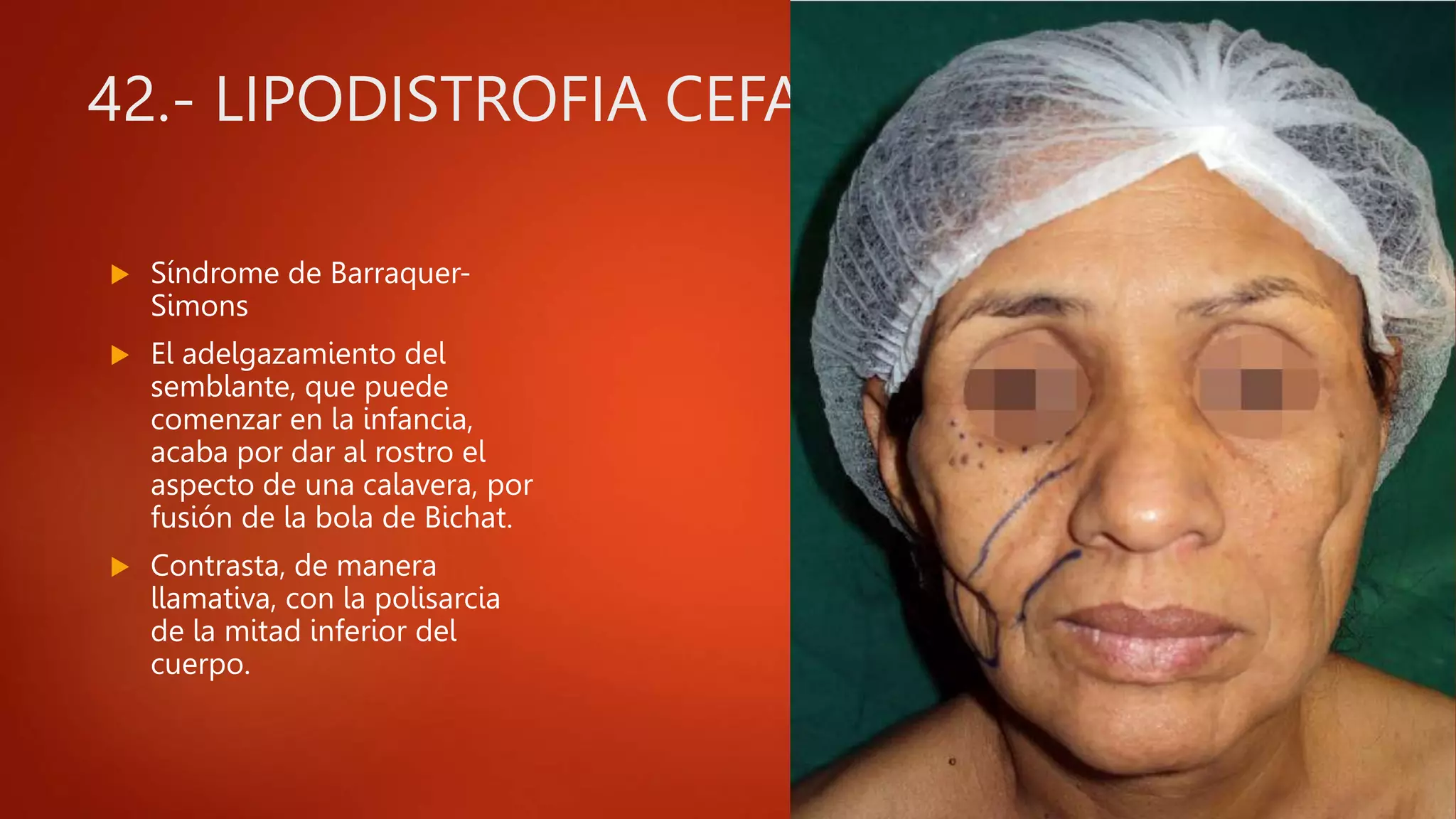 TIPOS DE FACIES | PPTX | Eye and Vision Conditions | Diseases and ...