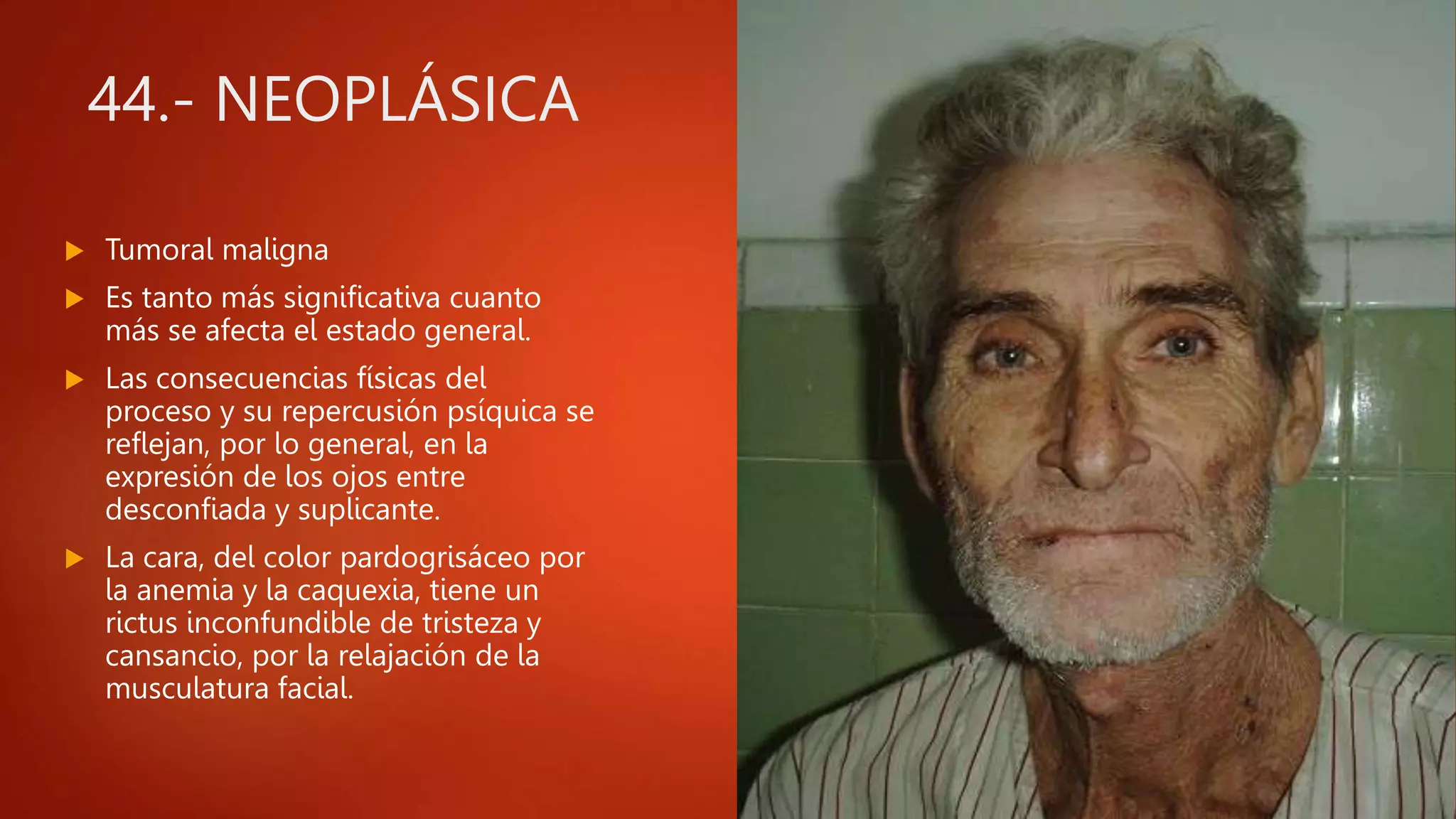 TIPOS DE FACIES | PPTX | Eye and Vision Conditions | Diseases and ...