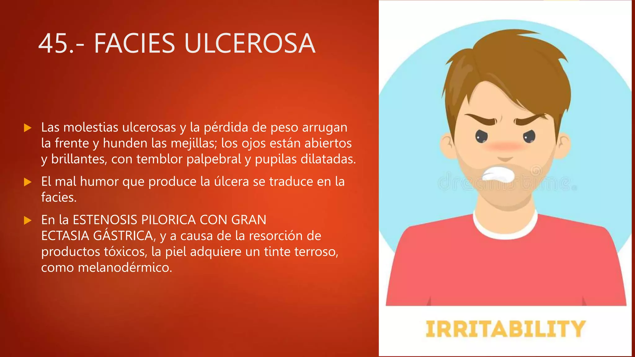 TIPOS DE FACIES | PPTX | Eye and Vision Conditions | Diseases and ...