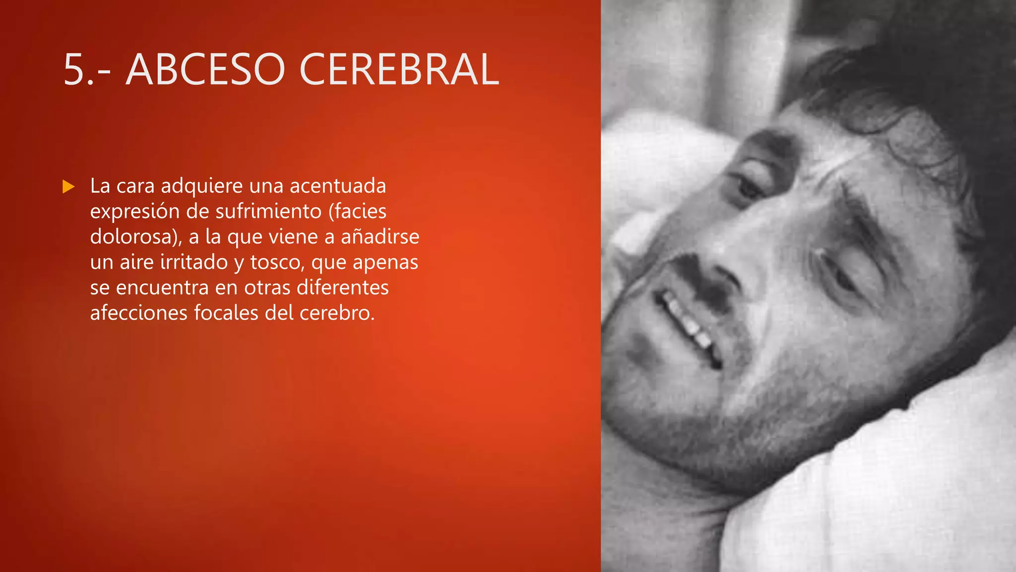 TIPOS DE FACIES | PPTX | Eye and Vision Conditions | Diseases and ...
