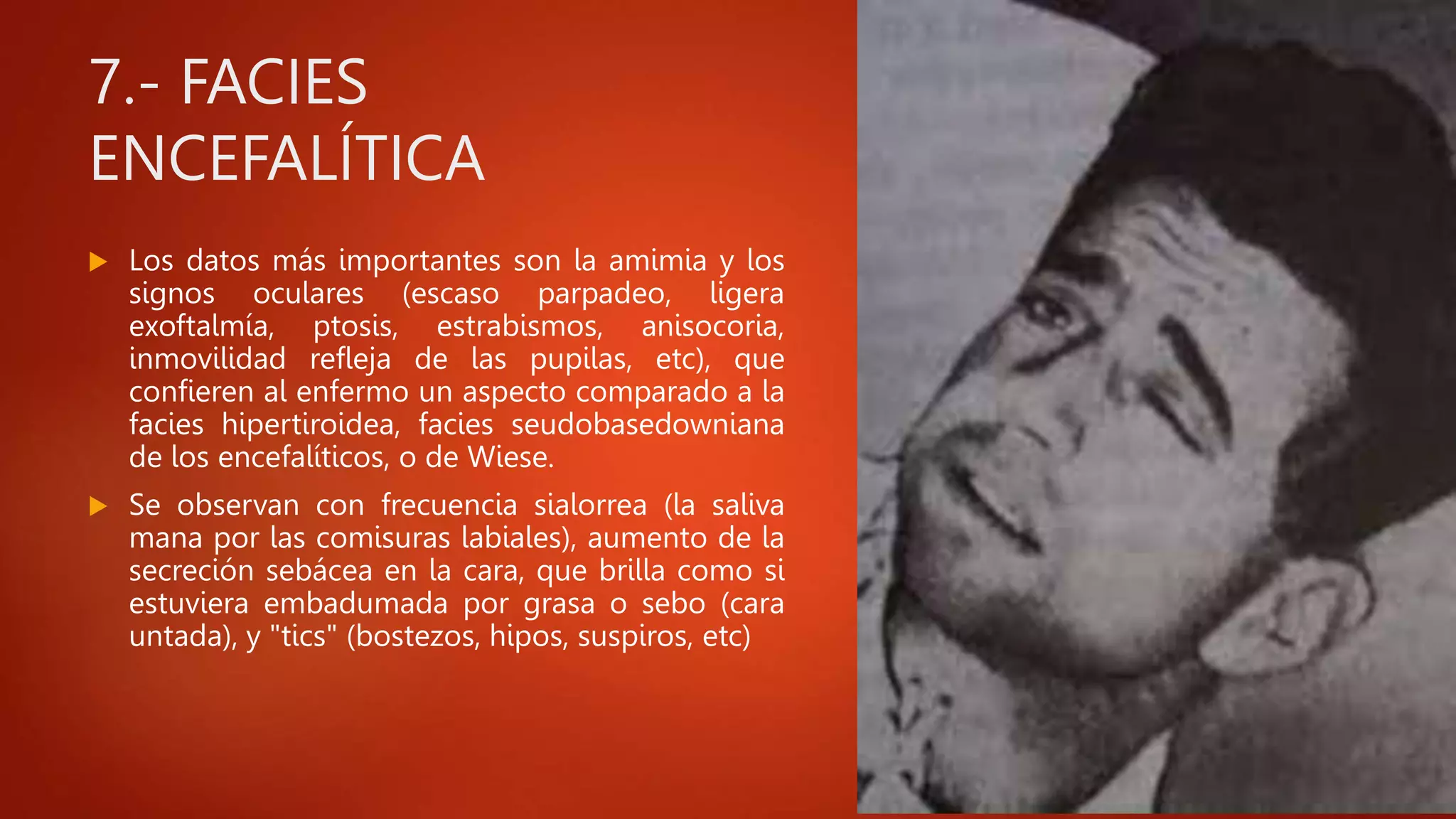 TIPOS DE FACIES | PPTX | Eye and Vision Conditions | Diseases and ...