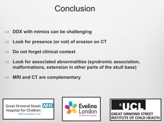 inflammations of the Temporal Bone: Imaging and differential diagnosis ...