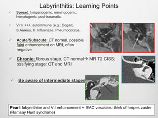inflammations of the Temporal Bone: Imaging and differential diagnosis ...