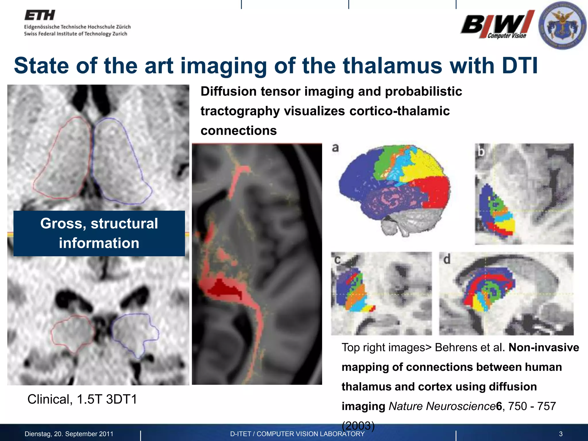 Connectivity-augmented Surgical Targeting: Individualization of a 3D ...
