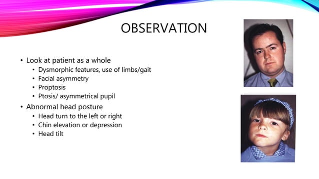 ESODEVIATION AND ITS APPROACH.pptx | Eye and Vision Conditions | Diseases and Conditions