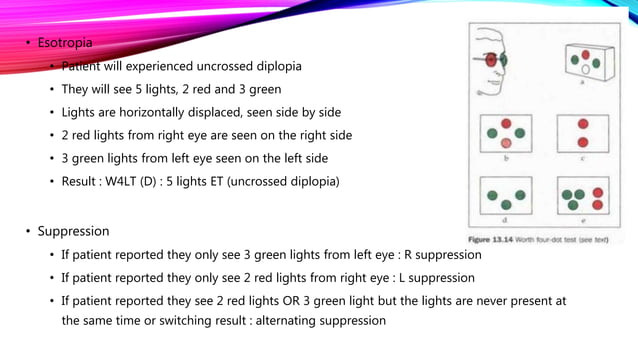 ESODEVIATION AND ITS APPROACH.pptx | Eye and Vision Conditions | Diseases and Conditions
