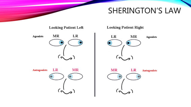 ESODEVIATION AND ITS APPROACH.pptx | Eye and Vision Conditions | Diseases and Conditions