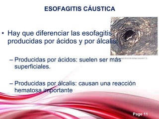 Esofagitis | PPT