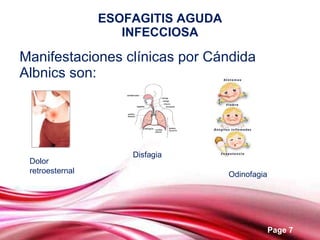 Esofagitis | PPT