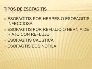 Esofagitis | PPTX