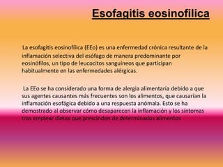 Esofagitis | PPTX
