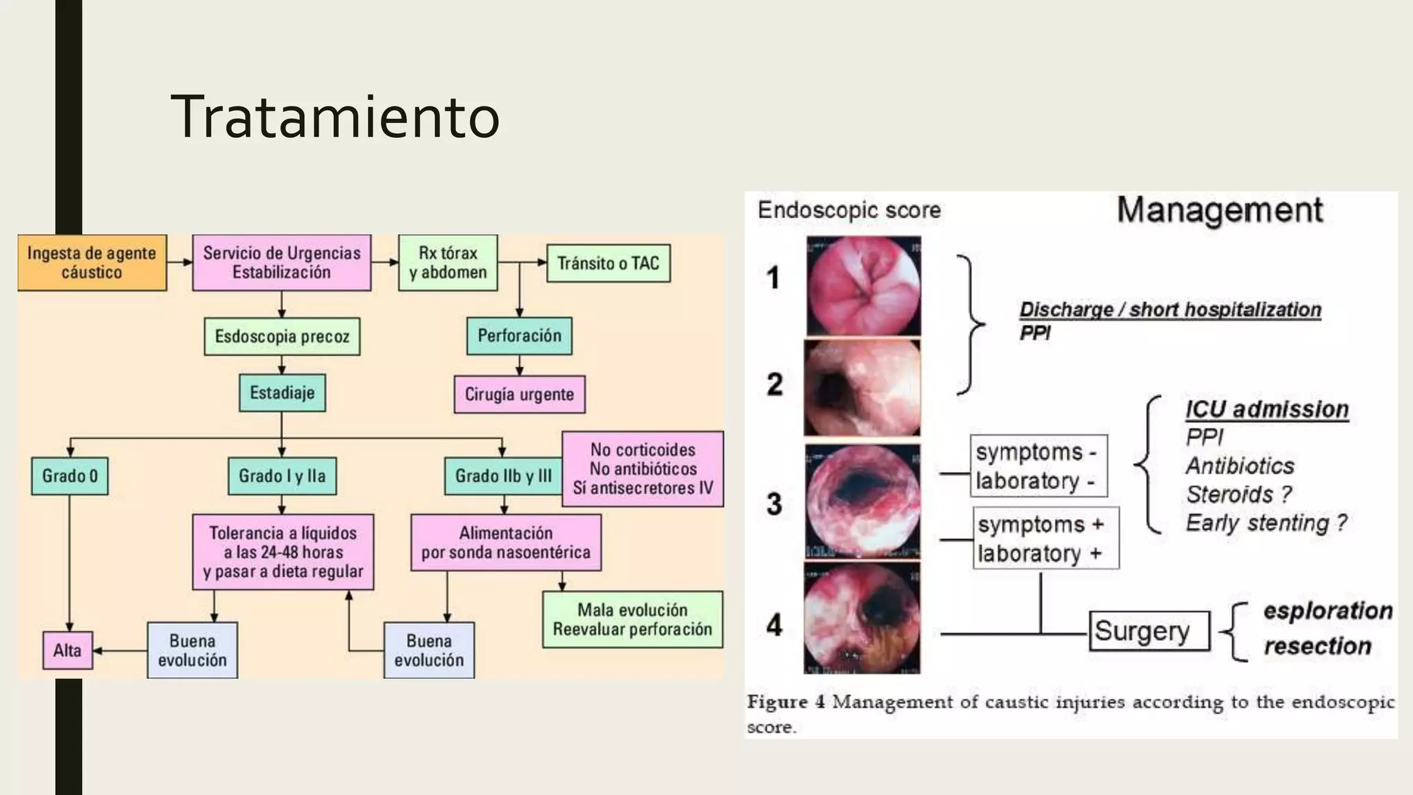 Esofagitis clasif angeles- esof barret | PPT
