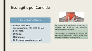 Esofagitis clasif angeles- esof barret | PPTX