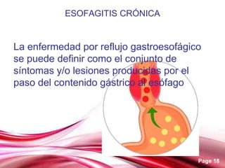 Tema esofagitis tema para exponer en clase | PPT