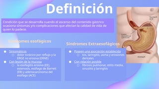 esofagitis benigna de la universidad de durango | PPTX