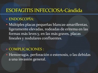 Esofagitis infecciosa y gastritis aguda | PPTX
