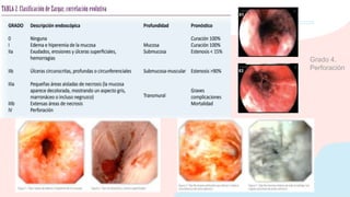 ESOFAGITIS POR CÁUSTICOS.pptx
