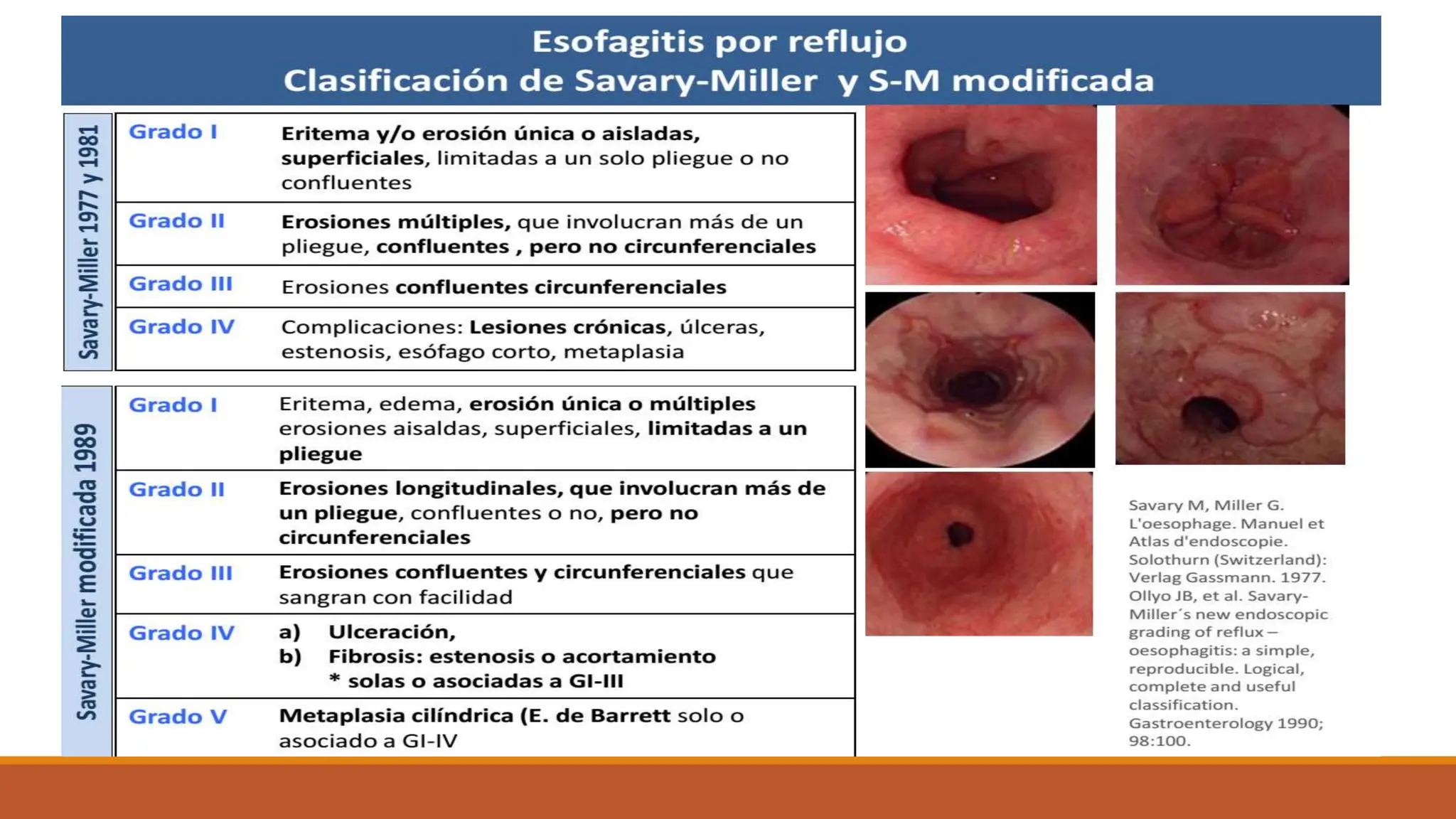 ESOFAGITIS POR REFLUJO GASTROESOFAGICO, ESOFAGITIS POSCAUSTICO Y.pptx