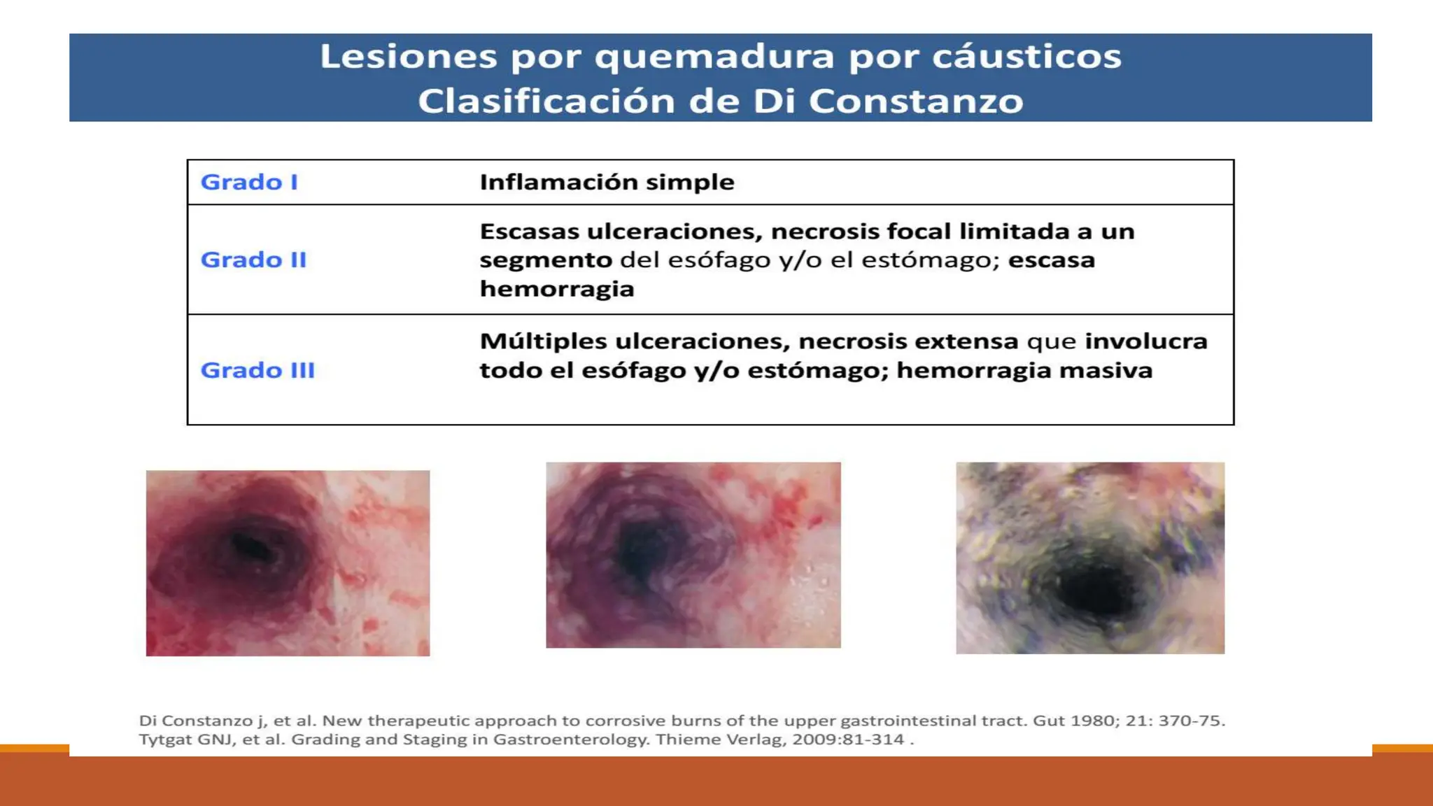 ESOFAGITIS POR REFLUJO GASTROESOFAGICO, ESOFAGITIS POSCAUSTICO Y.pptx