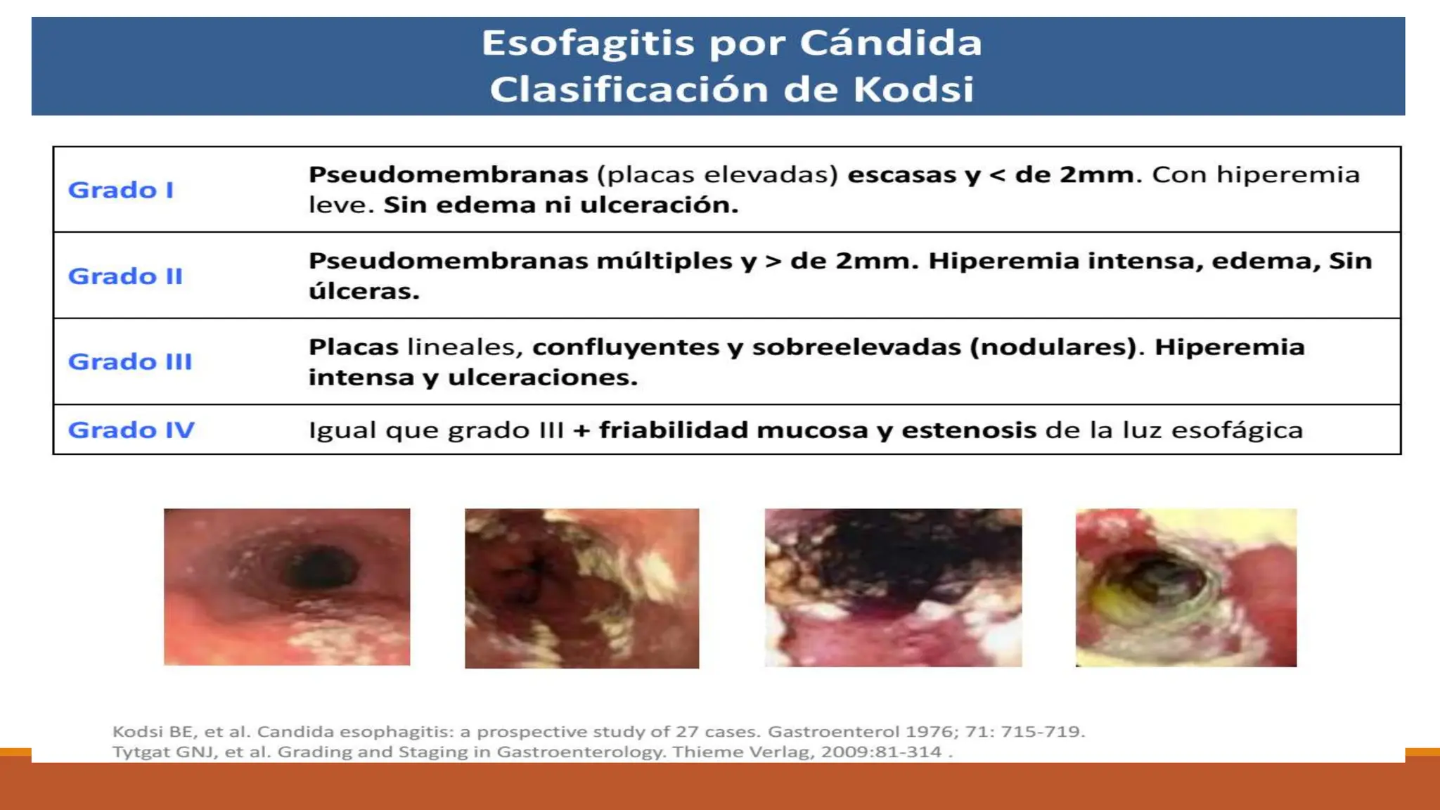 ESOFAGITIS POR REFLUJO GASTROESOFAGICO, ESOFAGITIS POSCAUSTICO Y.pptx