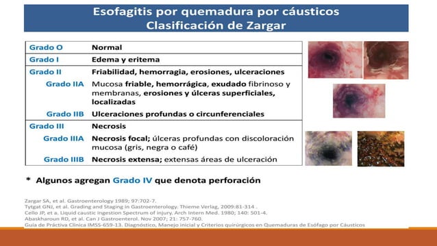 ESOFAGITIS POR REFLUJO GASTROESOFAGICO, ESOFAGITIS POSCAUSTICO Y.pptx