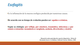 ESOFAGITIS POR REFLUJO GASTROESOFAGICO, ESOFAGITIS POSCAUSTICO Y.pptx