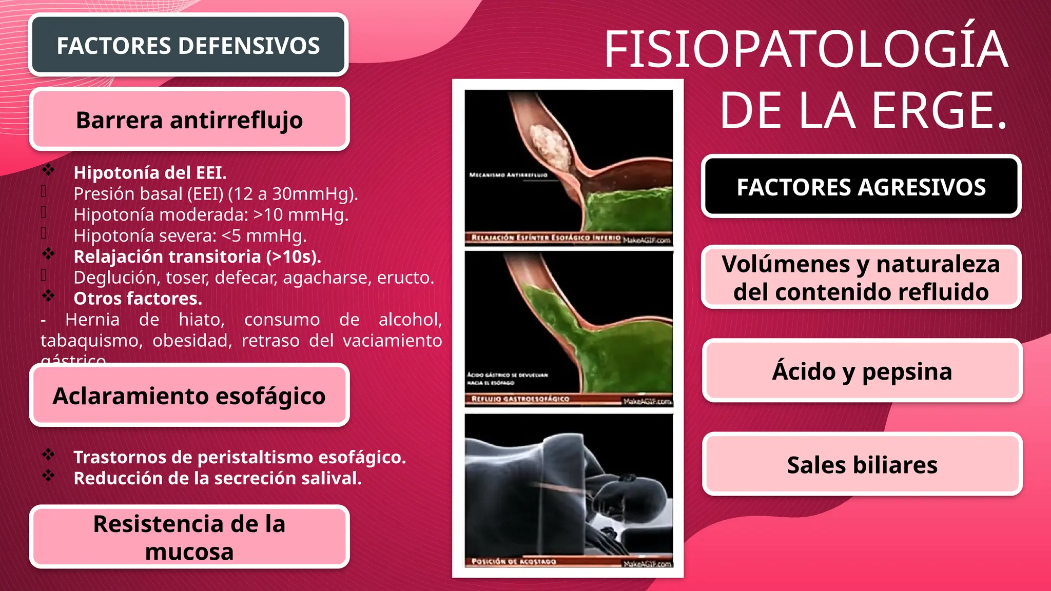 Esofagitis péptica Y ERGE y otros tipos.pptx