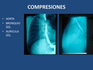 Esófago.Estómago y Duodeno.Estudios contrastados | PPT