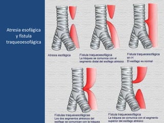 Esófago.Estómago y Duodeno.Estudios contrastados | PPT