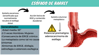 ESOFAGO.pdf
