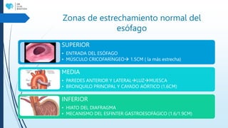 esofago.pptx