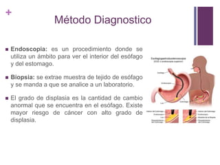 Esofago de Barrett | PPT