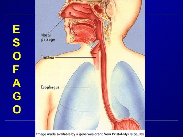 Esofago Ingestione Caustici | PPT