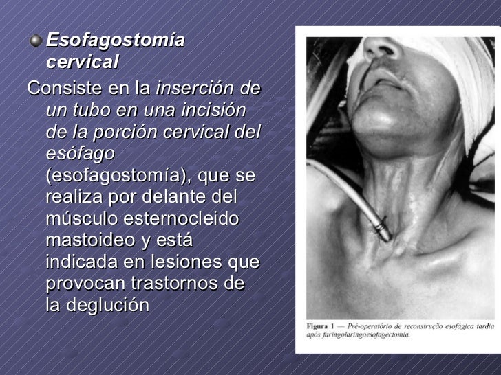 Esofago 2010 anatomia y tecnica