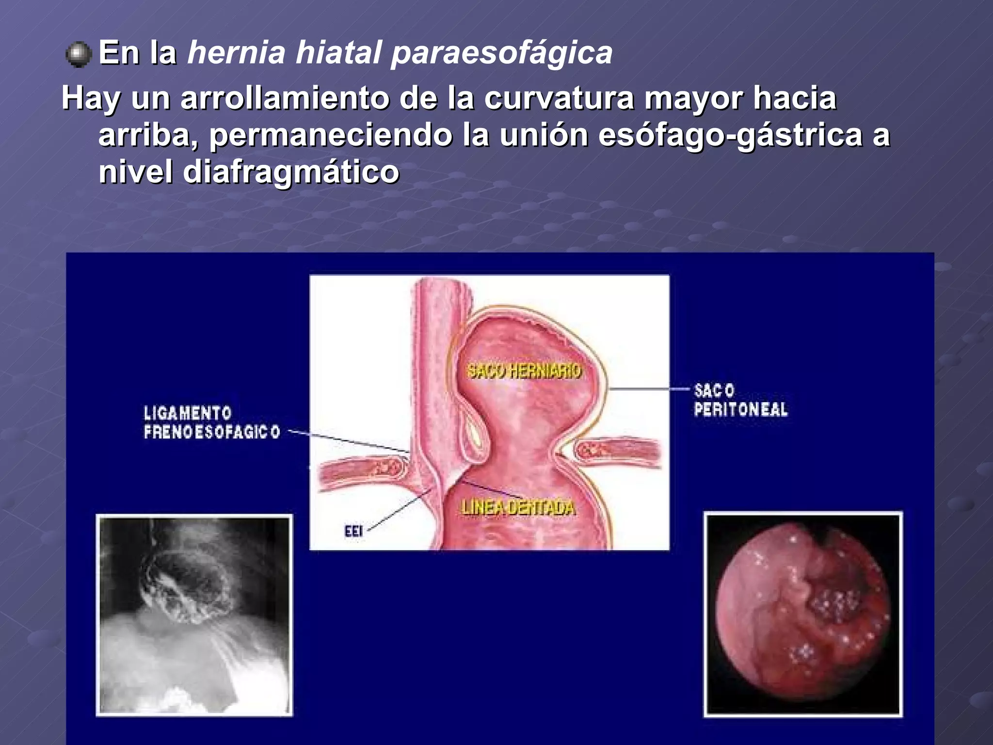 Esofago 2010 anatomia y tecnica | PPT