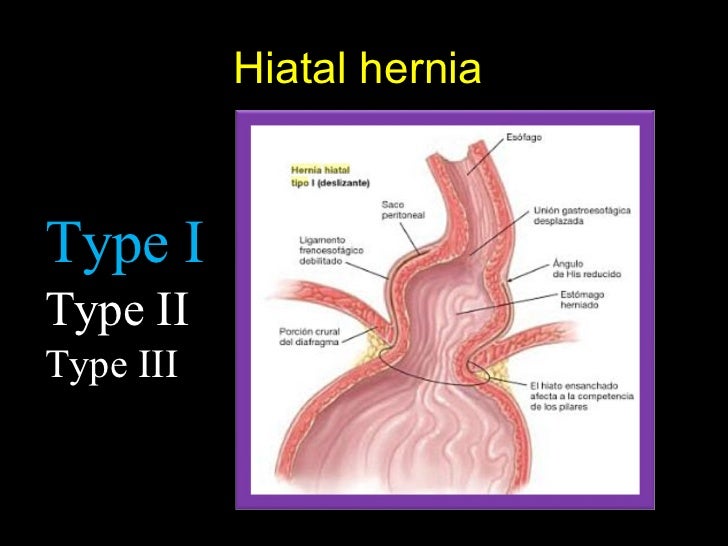 Esophageal pathology