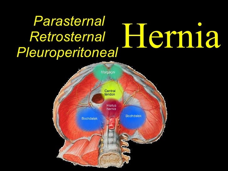 Esophageal pathology