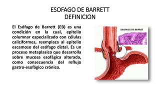 esofago de barret ppt 2020 ACTUAL.pptx
