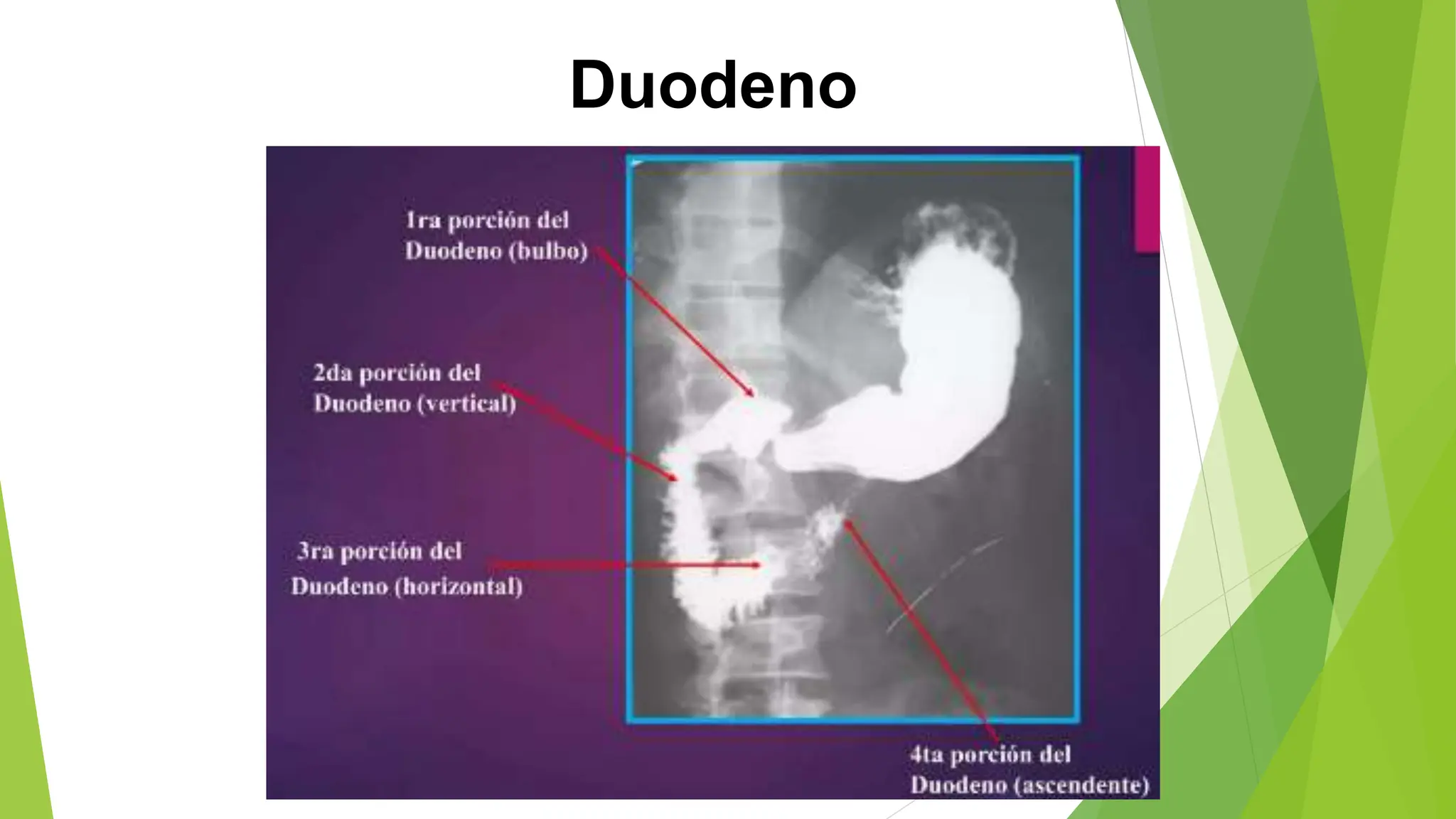 Esofago,estomago y duodeno, anatomia yusde.pptx