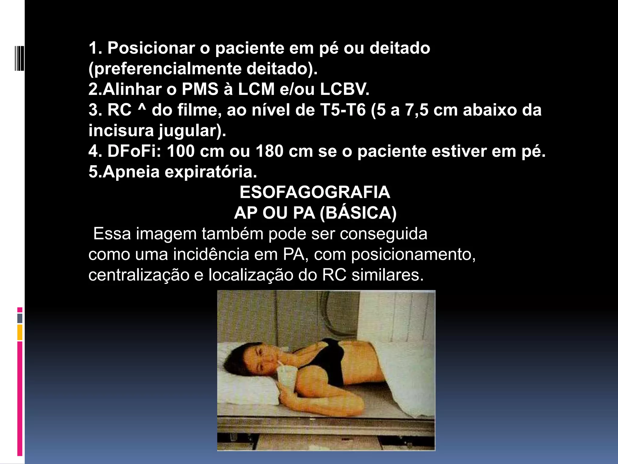 Esofagografia | PPTX