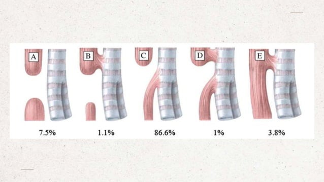 Esofagografi pada Atresia Esofagus (Tinjauan Pustaka) Matthew ...