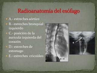 Esofagograma | PPTX