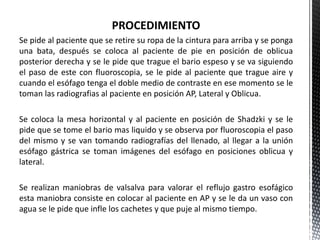 Esofagograma | PPTX