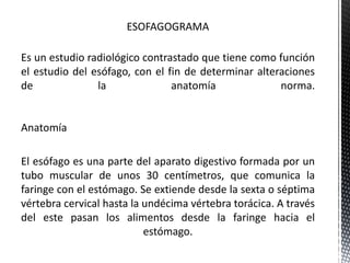 Esofagograma | PPTX