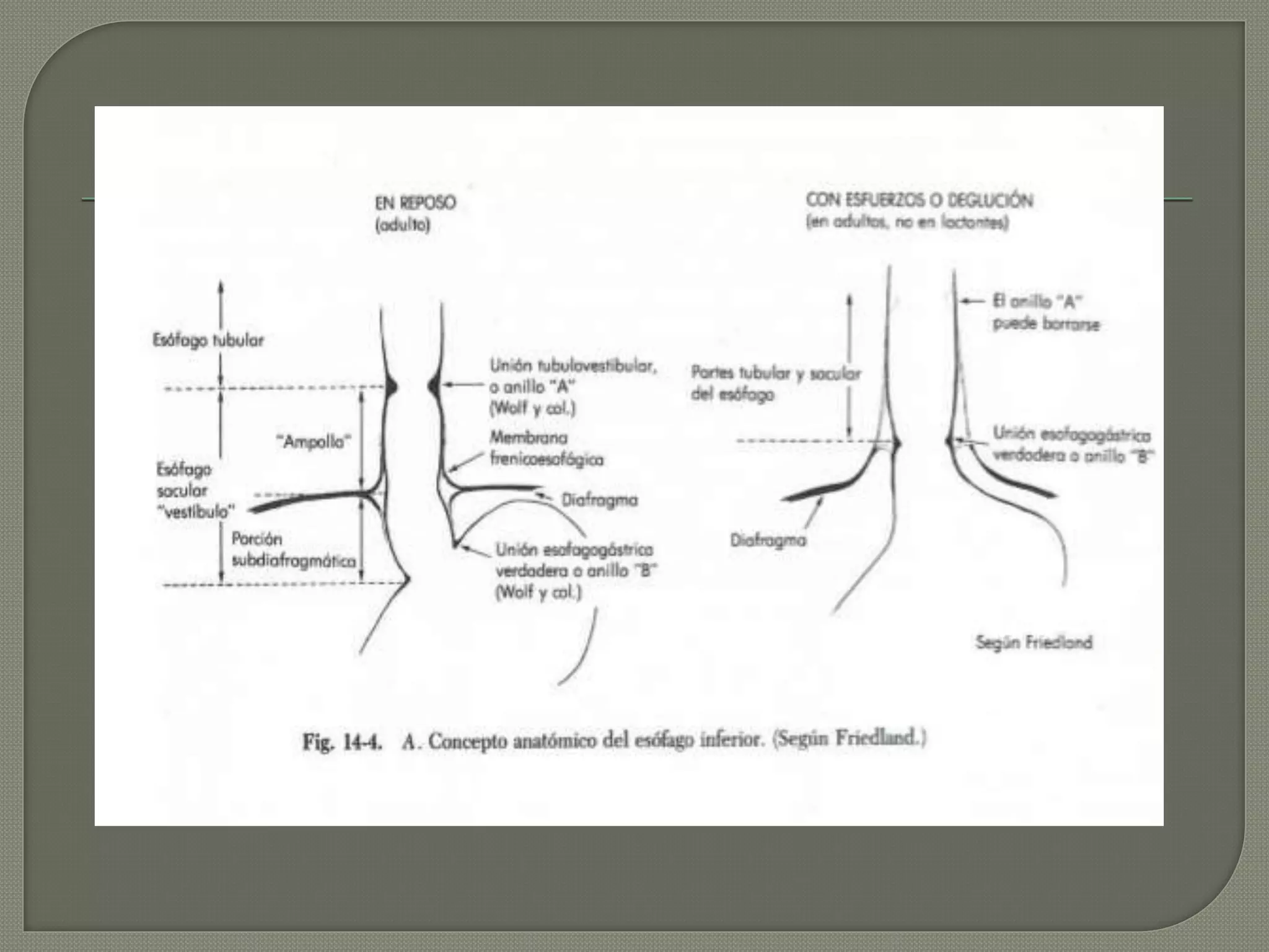Esofagograma y Anatomía (Radiología Convencional) | PPTX