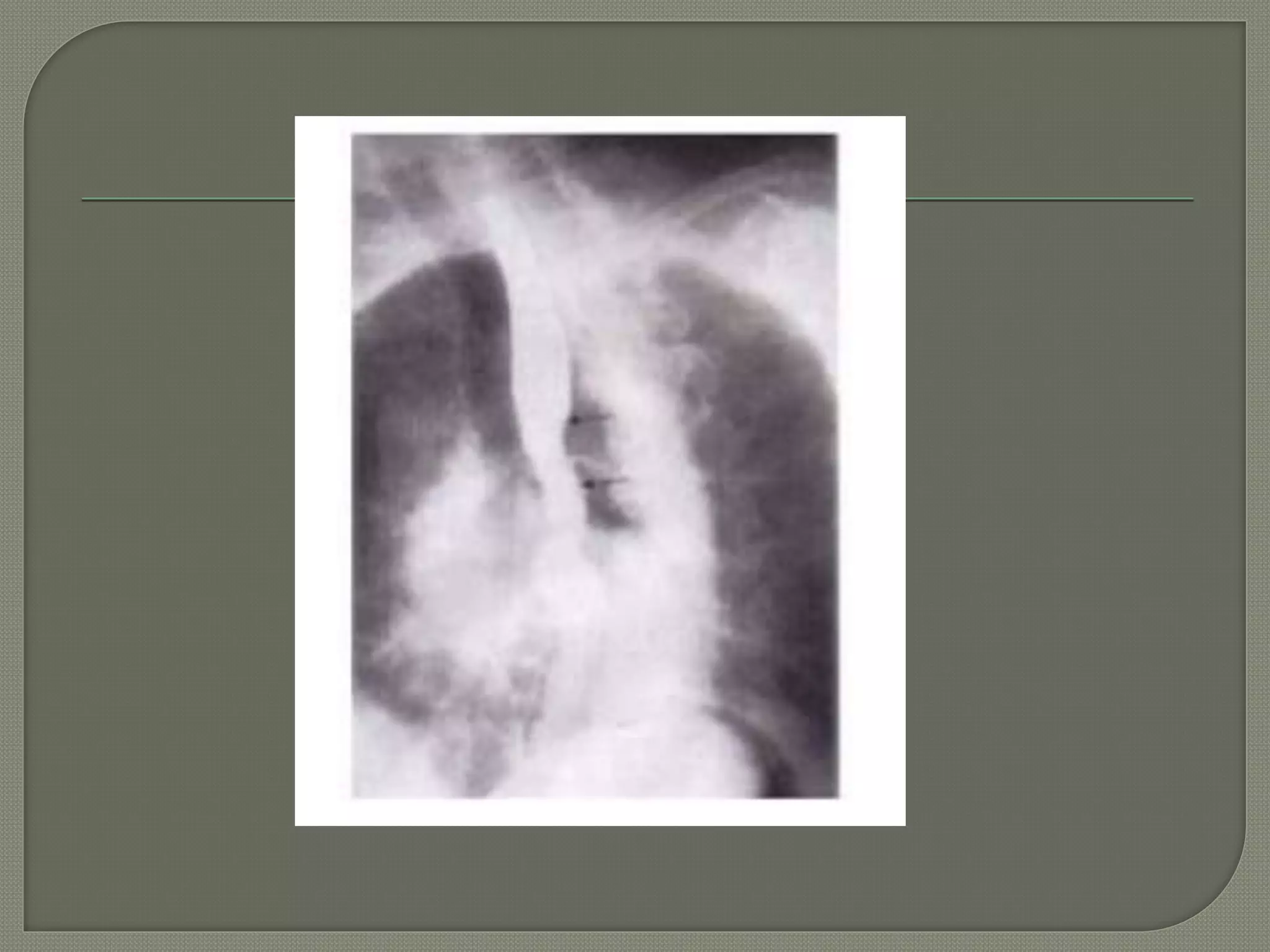 Esofagograma y Anatomía (Radiología Convencional) | PPTX