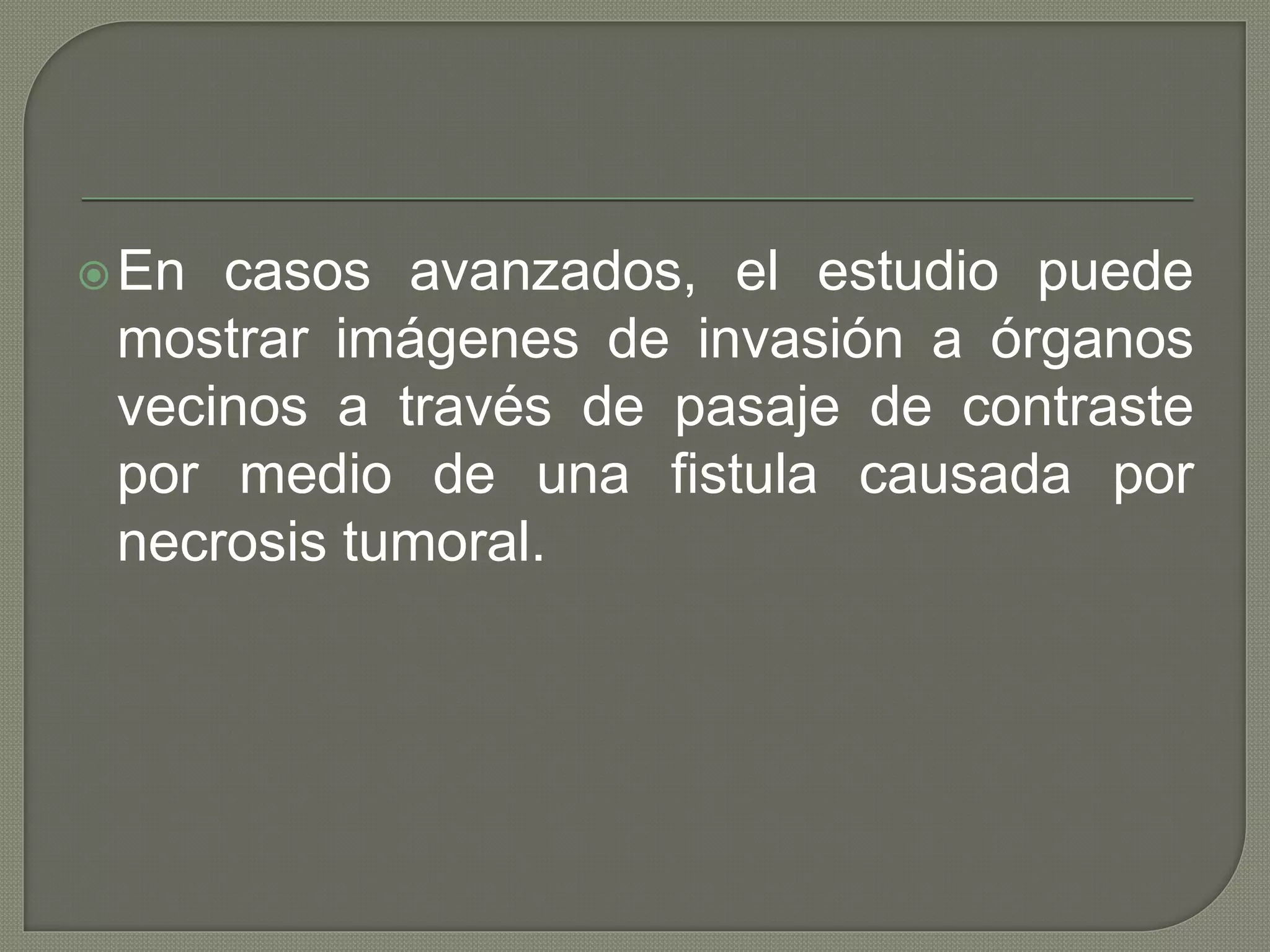 Esofagograma y Anatomía (Radiología Convencional) | PPTX