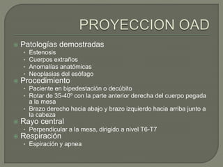 Esofagograma y Anatomía (Radiología Convencional) | PPTX