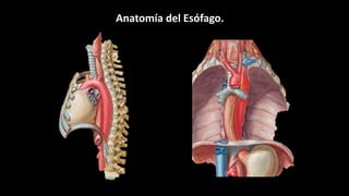 Esofagograma.pptx